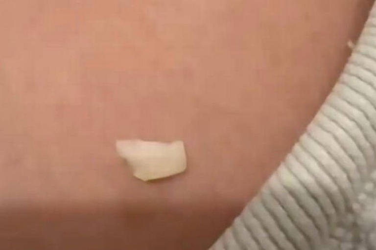 Kate Garraway's 'teeth fall out' after collision with taxi