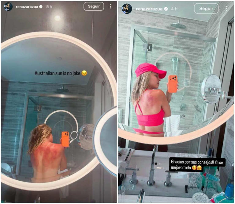 Renata Zarazúa termina su participación en Hobart y muestra quemaduras ...