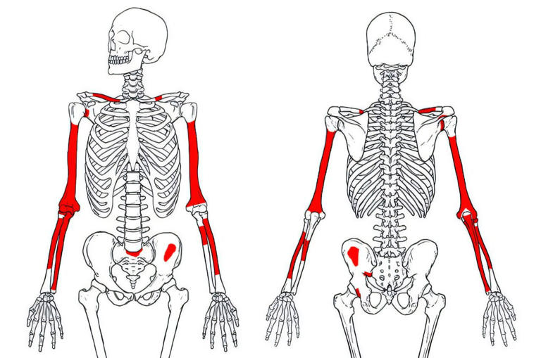 Homo habilis: The oldest and most complete skeleton discovered to date