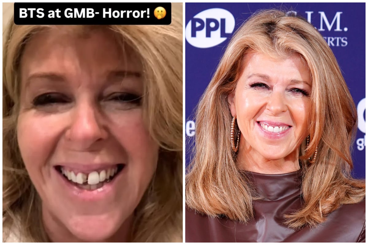 Kate Garraway's teeth fall out before going live on GMB