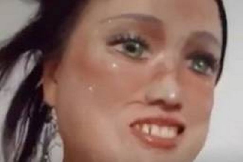 'My parents arranged my marriage - he burned my face with acid and now ...