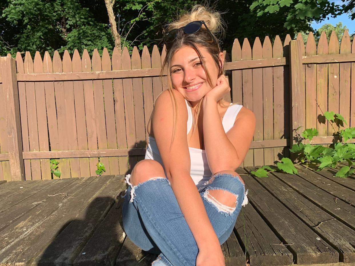 26-year-old thought it was hemorrhoids - diagnosis was stage 4 colon cancer