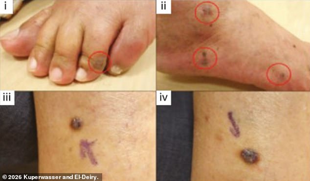 Shocking study linking COVID jabs and cancer 'censored' by mysterious ...