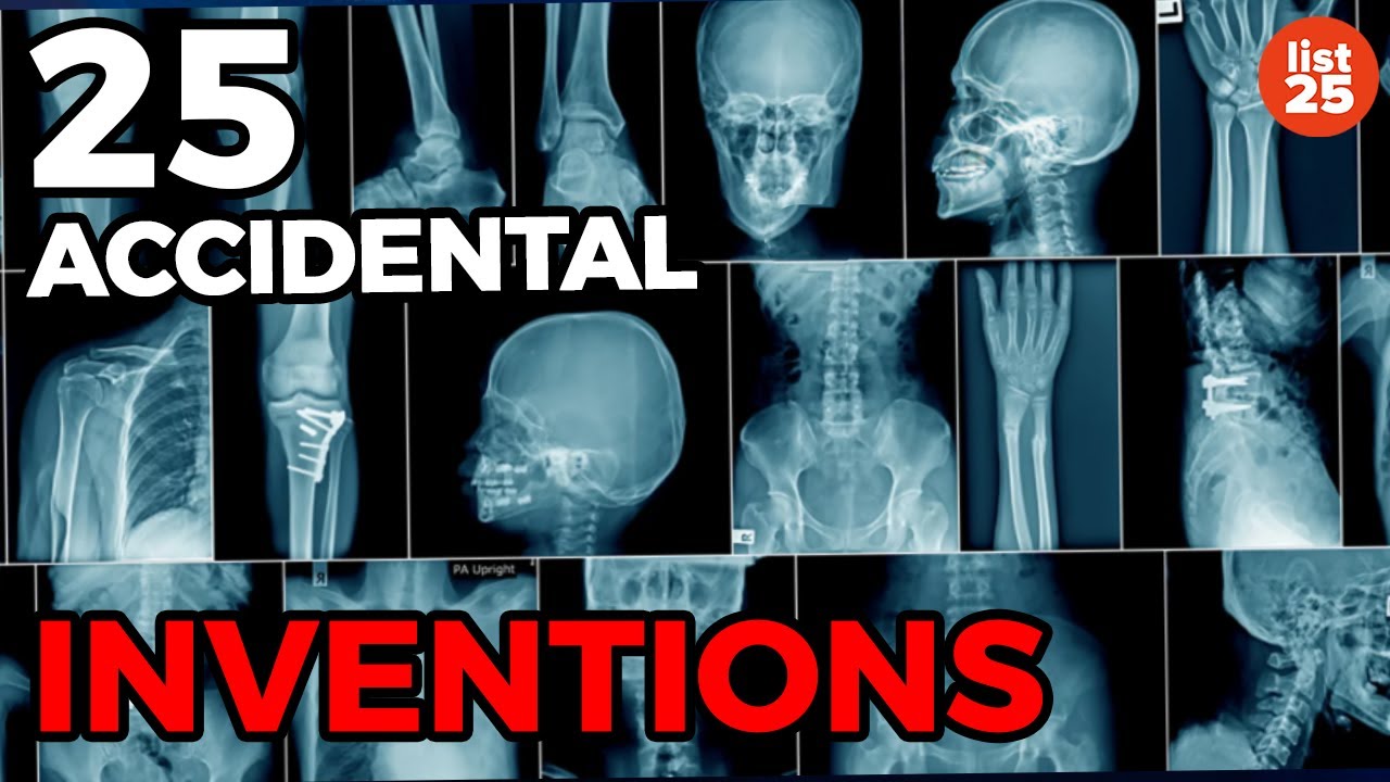 25 accidental inventions that changed human history