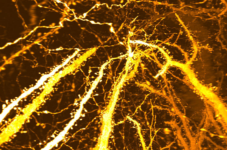 New synaptic formation in adolescence challenges conventional views of ...