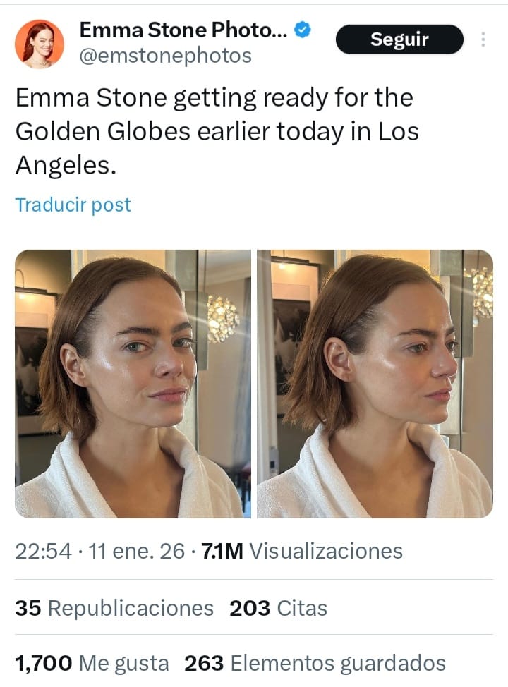 Emma Stone se convirtió en un blanco de críticas por sus retoques ...