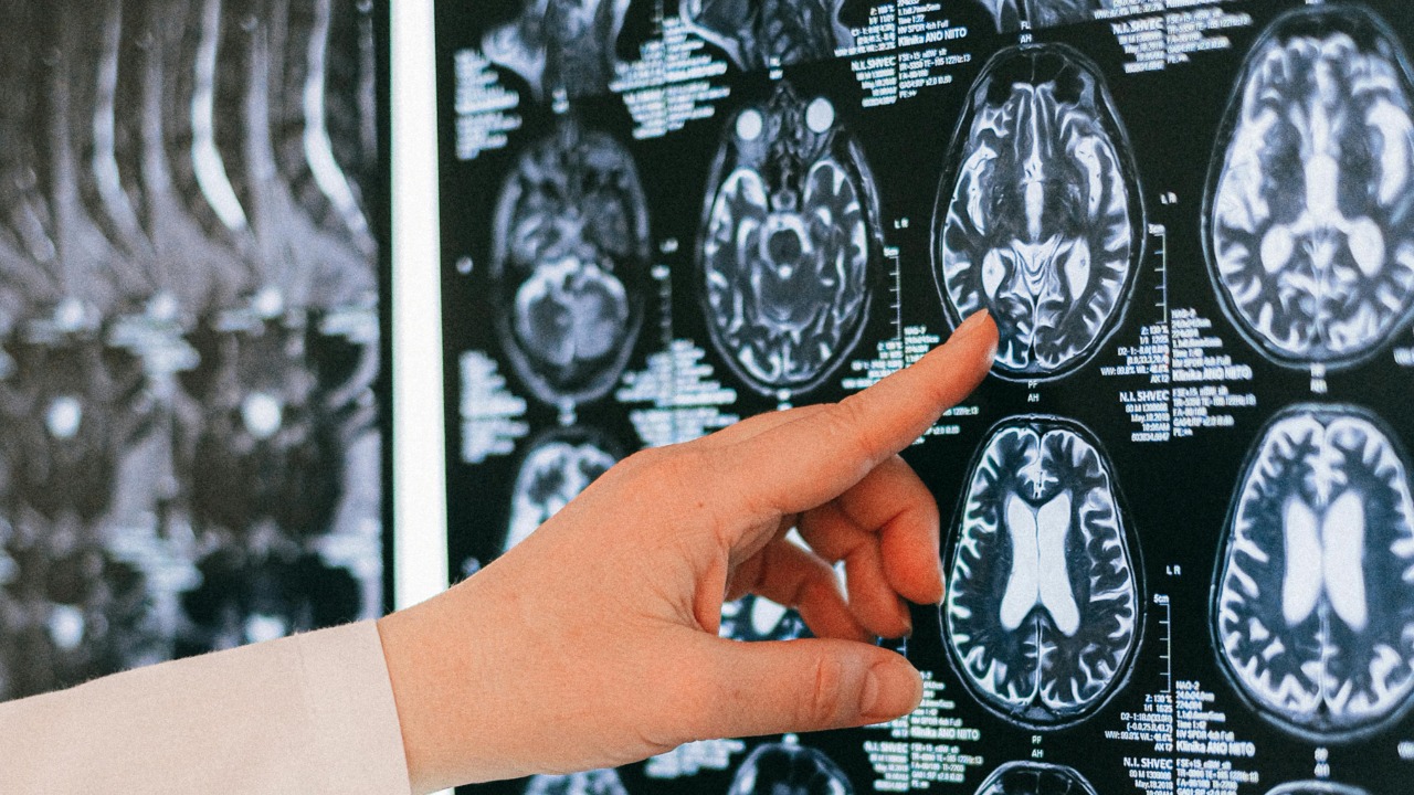 Scientists map 5 dramatic phases of brain structure across your life