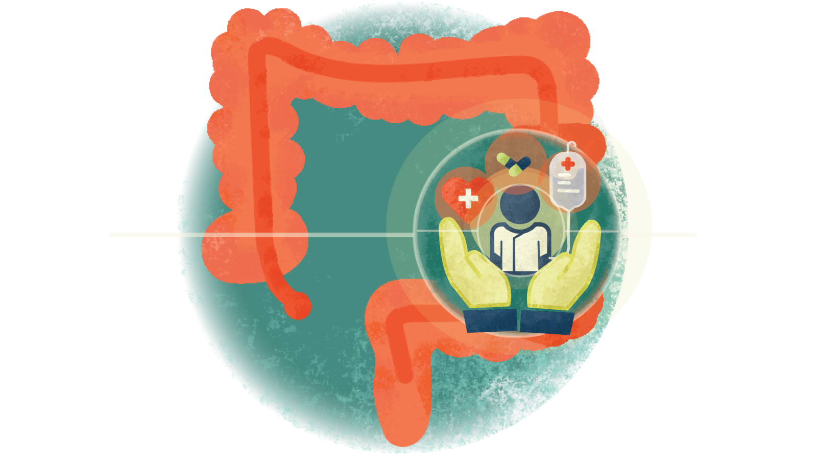 Gastric cancer's individualized patient-centered treatment approach