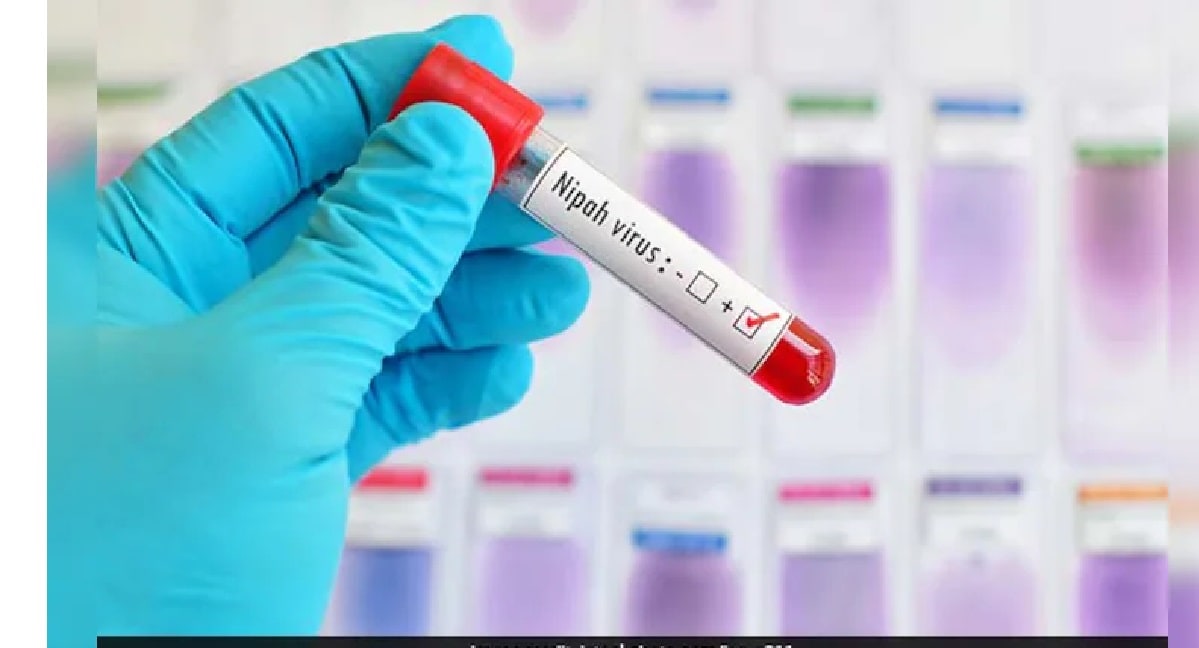 2 more healthcare workers with Nipah symptoms admitted to Bengal hospital