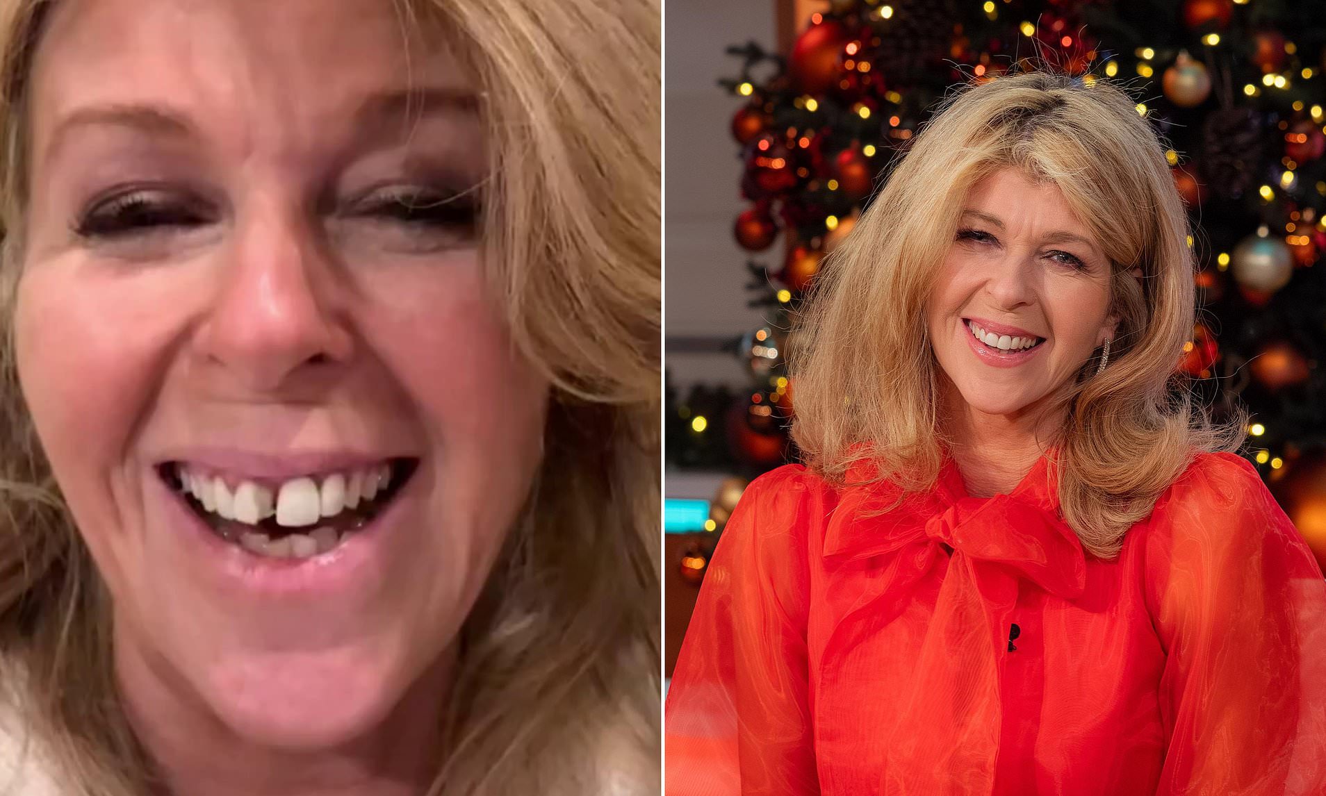 Kate Garraway suffers backstage 'horror' as her front teeth fall out ...
