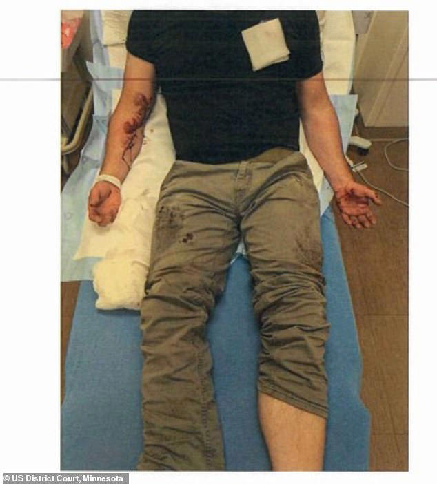 ICE agent Jonathan Ross suffered internal bleeding after encounter with ...