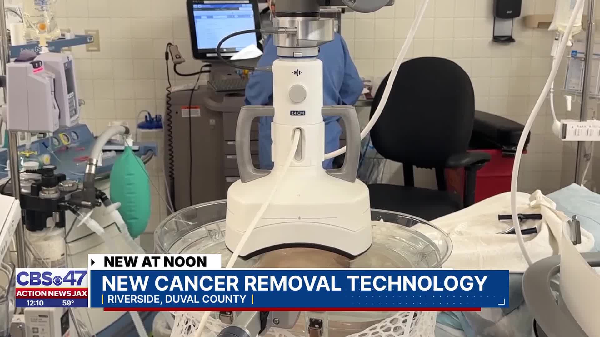 Local hospital gets new technology to perform non-invasive surgery to ...