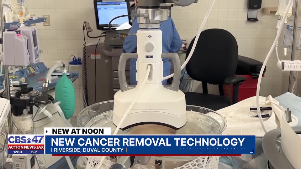 Local hospital gets new technology to perform non-invasive surgery to ...