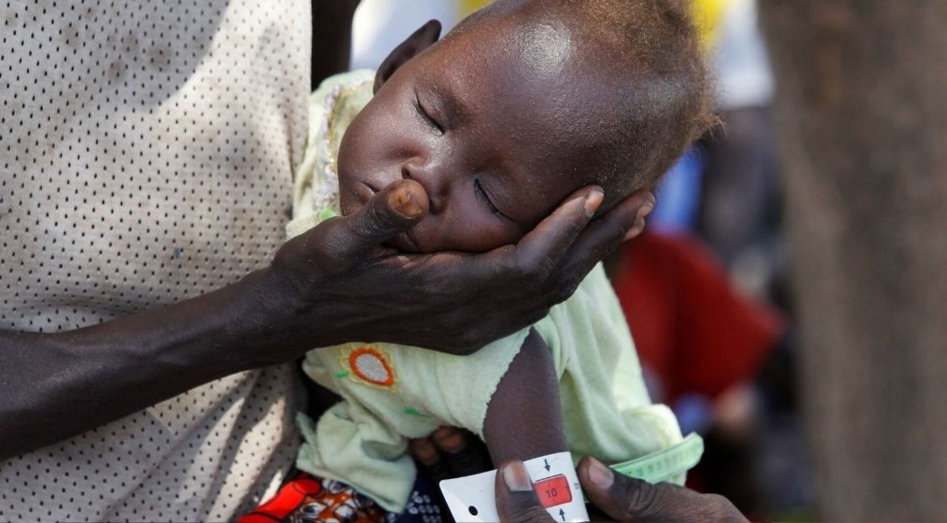 Northern Kenya faces severe child malnutrition crisis driven by ...