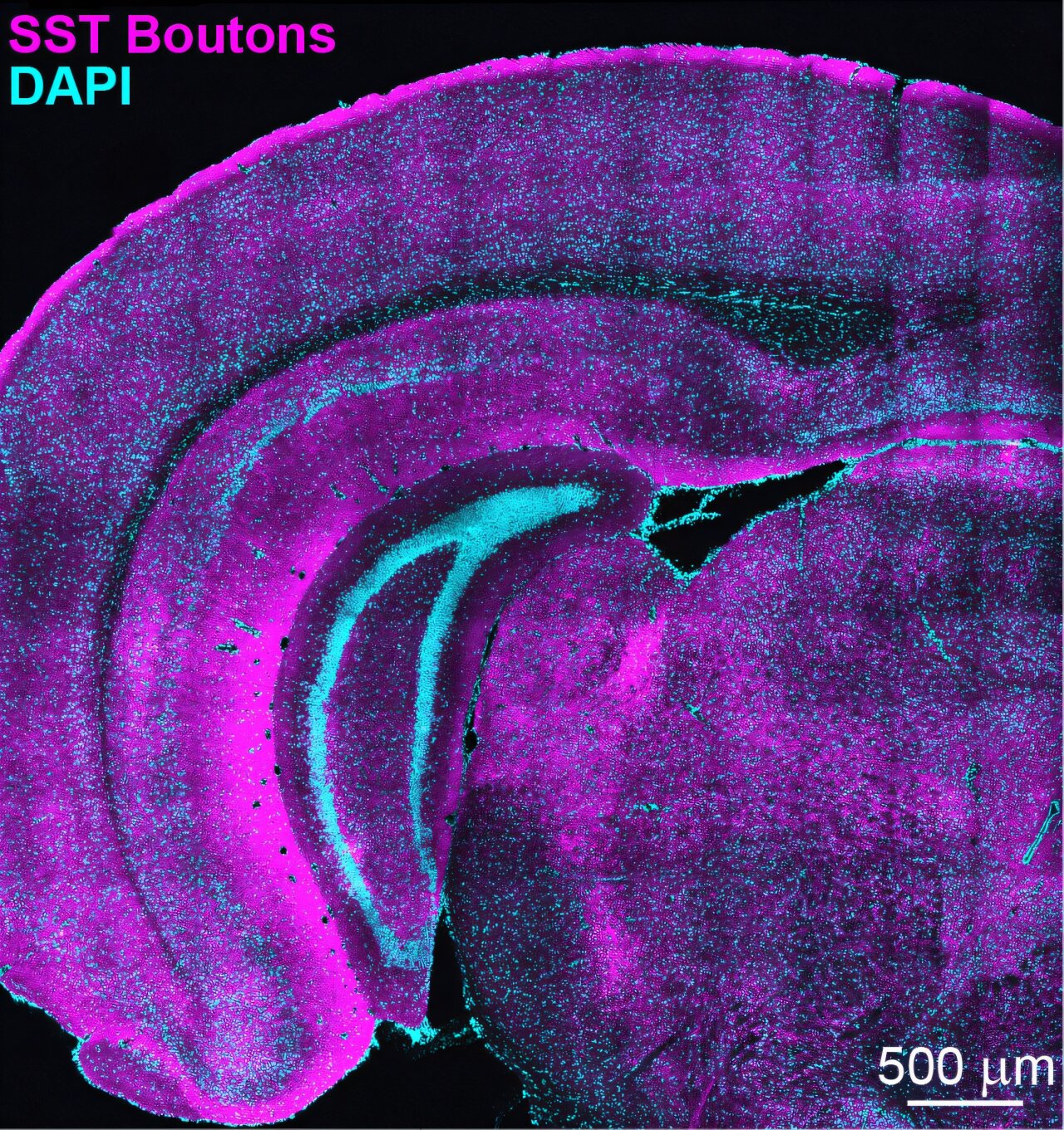 How a unique class of neurons may set the table for brain development