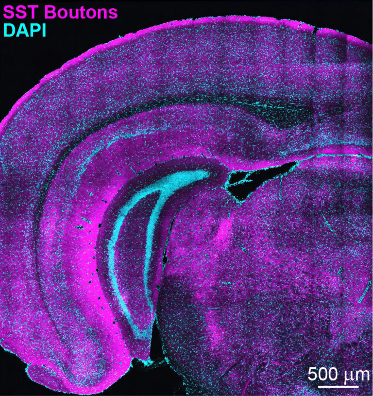 How a unique class of neurons may set the table for brain development