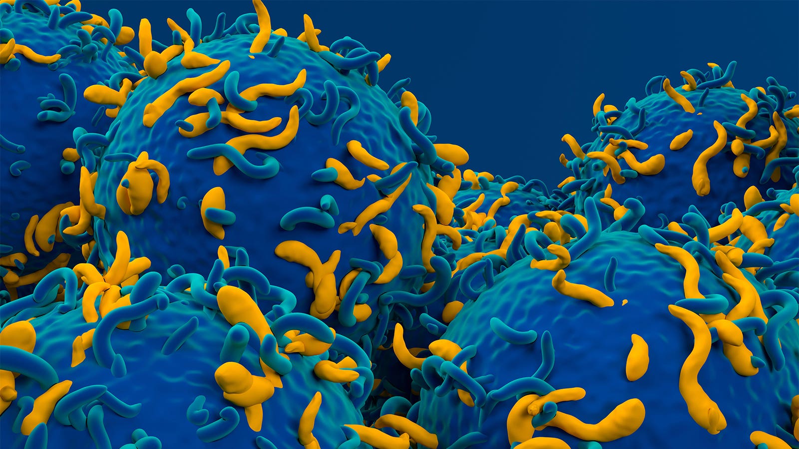 Autoimmune anemia is the latest condition found responsive to CAR-T therapy