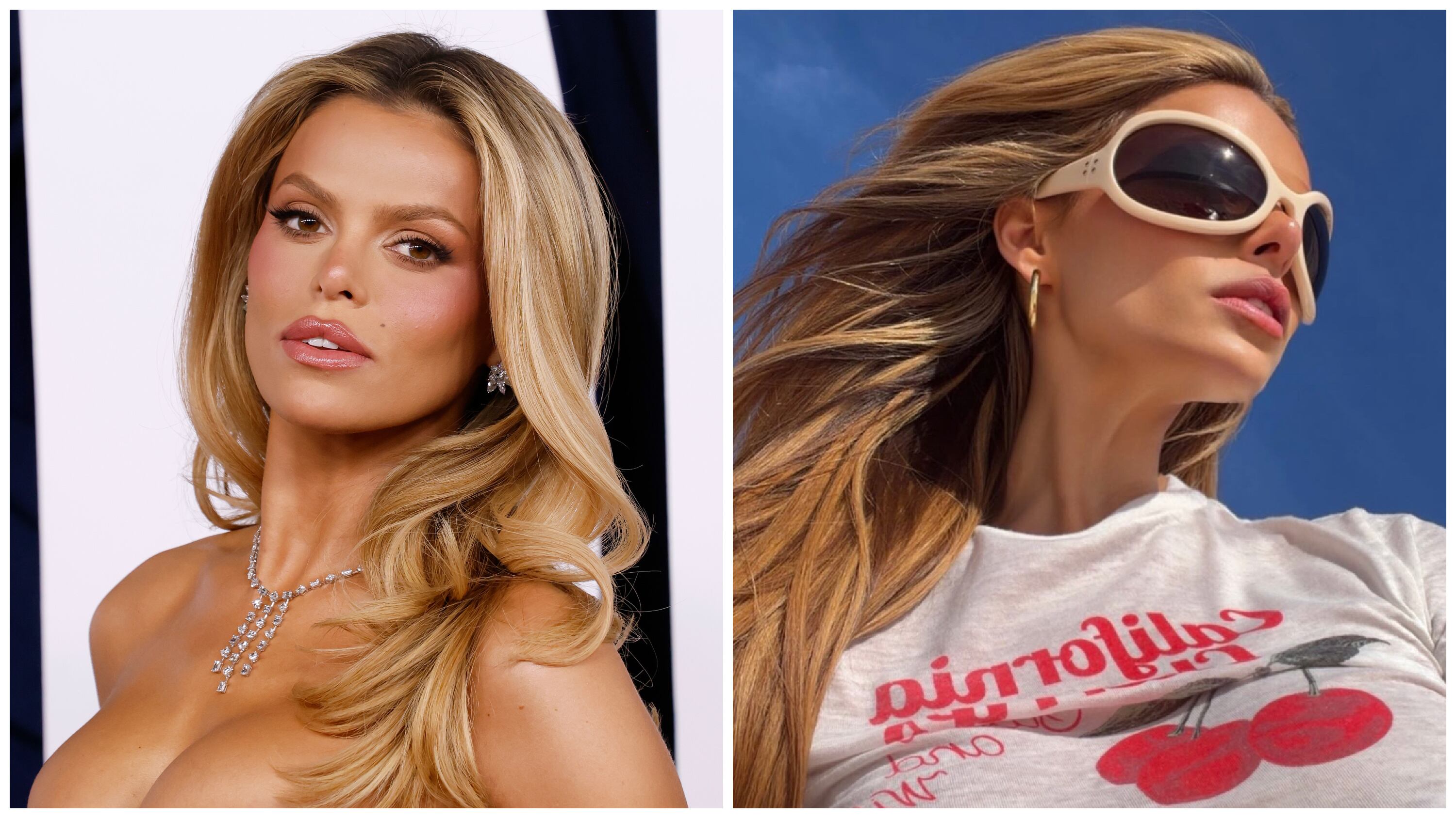 Woman shows off 'old lips' after getting her injections dissolved