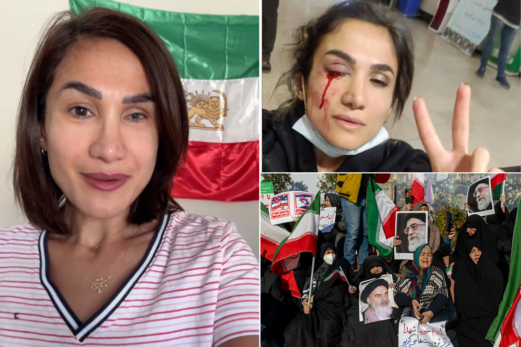 Iranian mom who lost eye to bullet in 2021 hijab protest now lives in ...