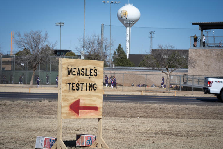 At least 171 measles cases confirmed in 9 states, CDC data shows