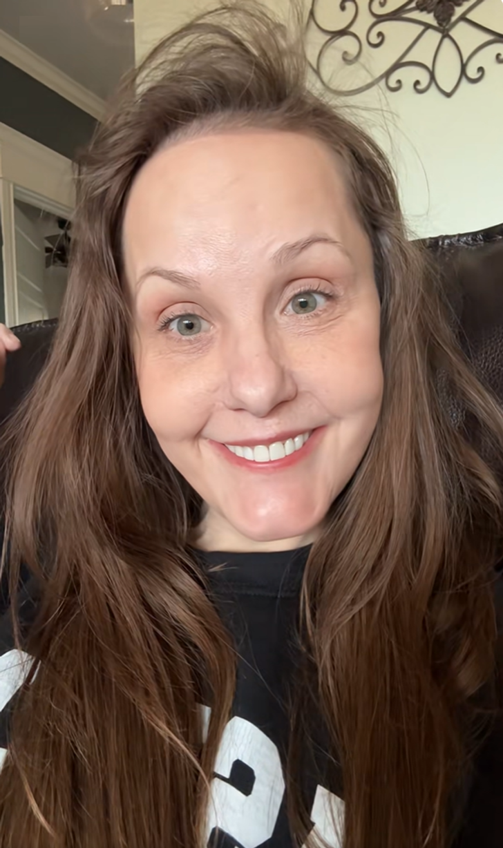 Woman, 50, reveals her dramatic plastic surgery results — and people ...