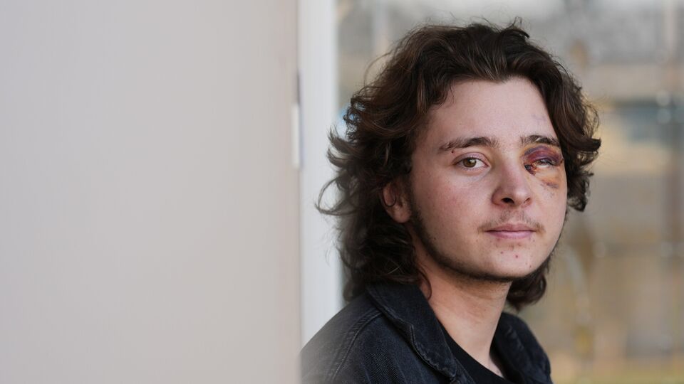 California protester loses eye, Minnesota man shot in leg amid anti-ICE ...