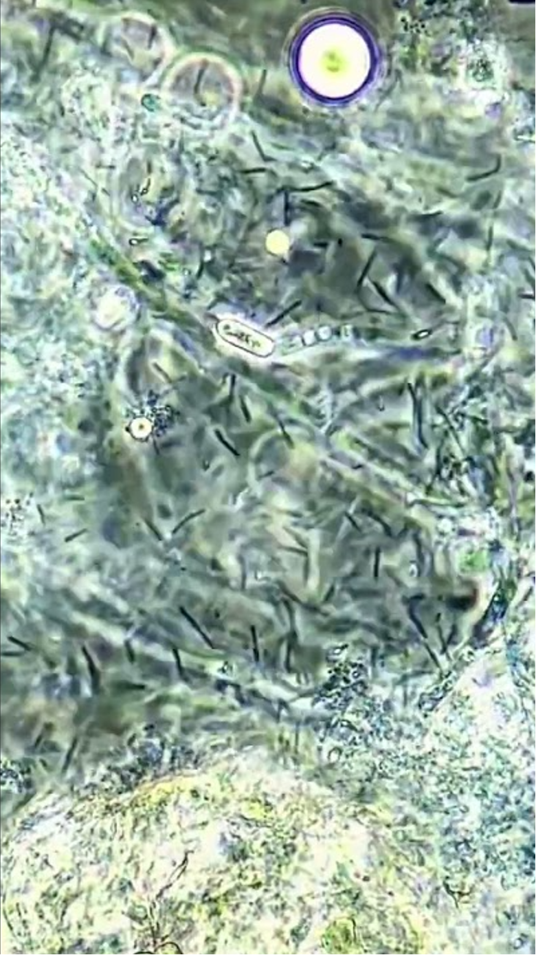 Bacteria VS hydrogen peroxide under the microscope