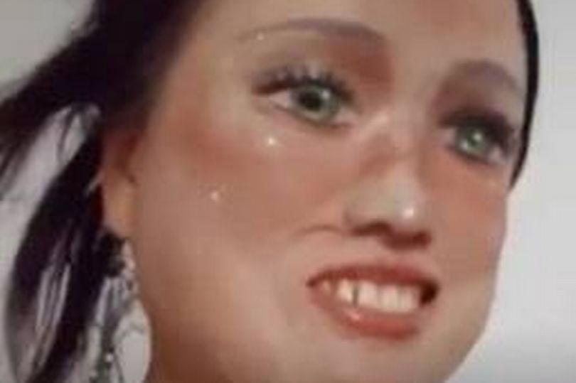 Acid attack survivor draws on eyes with make-up after ex-husband attack ...