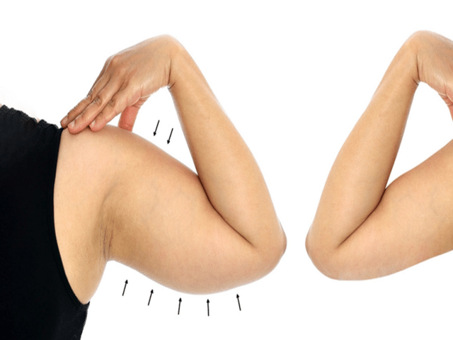 Health tips: Troubled by flabby arms? Then try these 5 exercises at ...