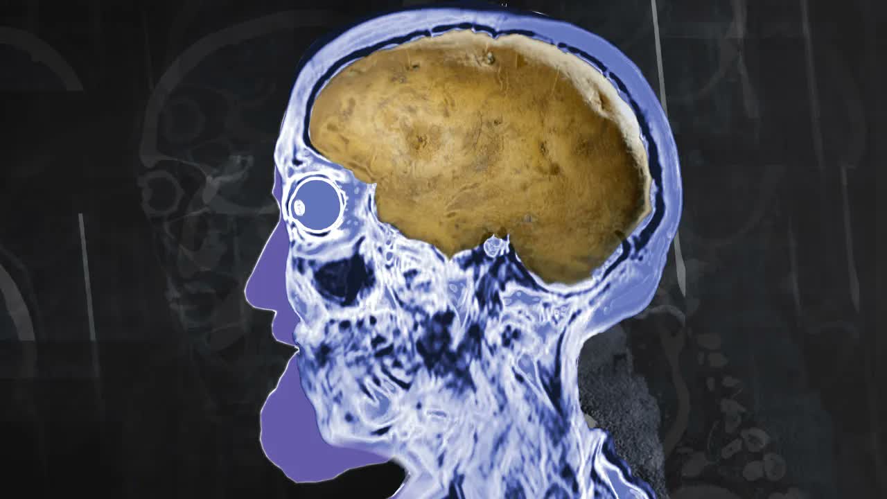 How eating a two-week-old baked potato led to a fatal infection