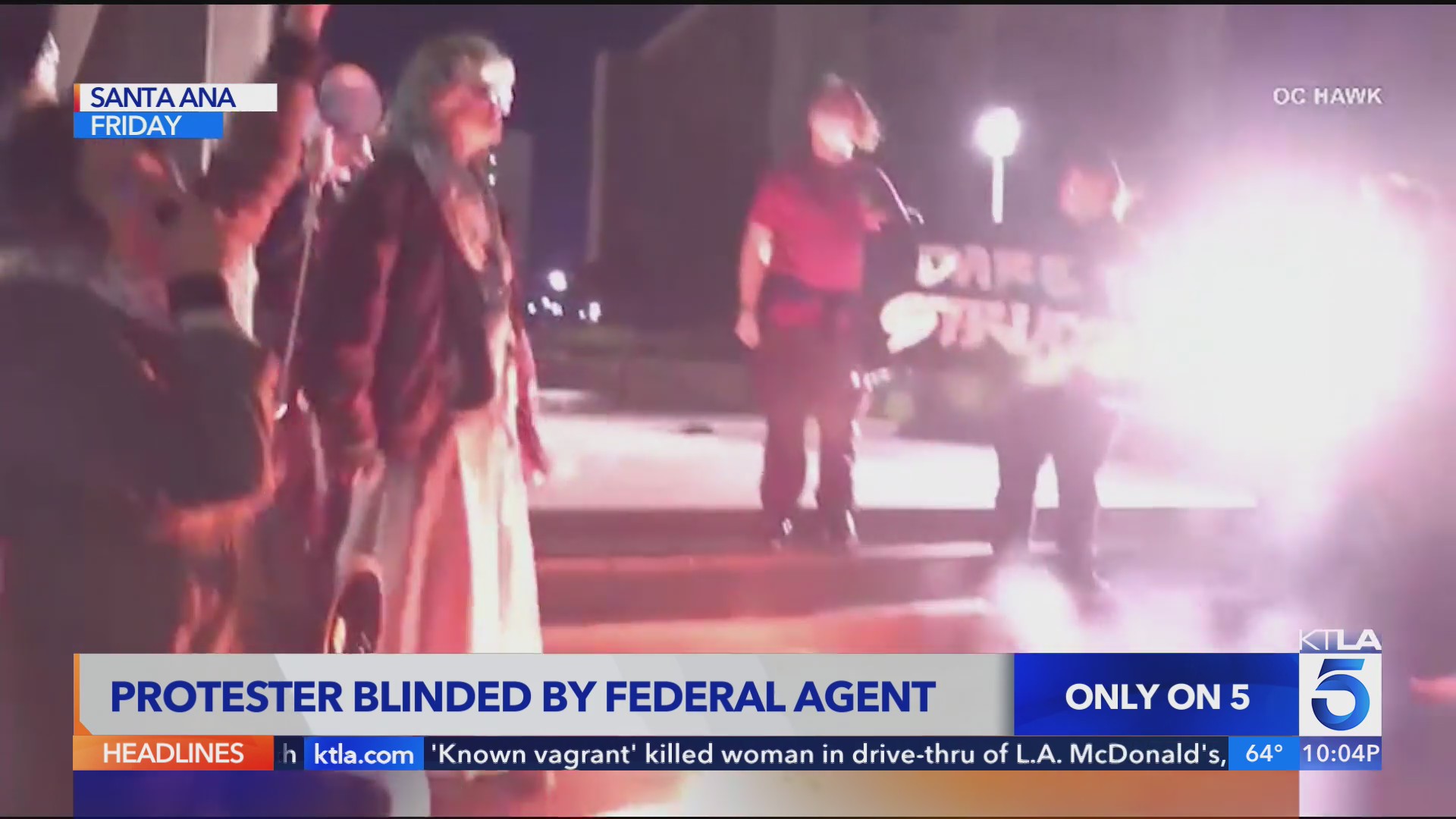 Protester blinded by federal agent in Santa Ana