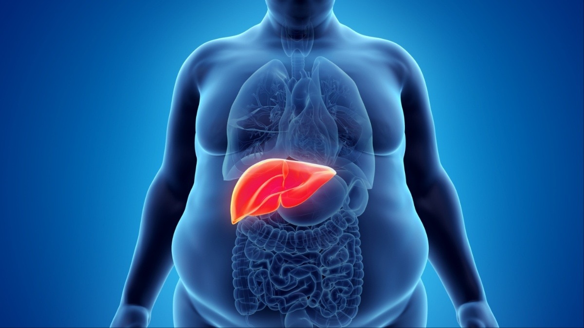 India sees alarming surge in fatty liver disease, ranks among global top 3