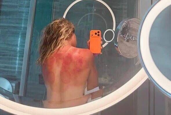 Australian Open star shares worrying health warning after suffering ...