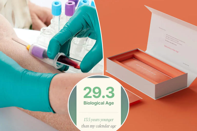 I gave lots of blood for 6 longevity tests — here’s how long I can ...