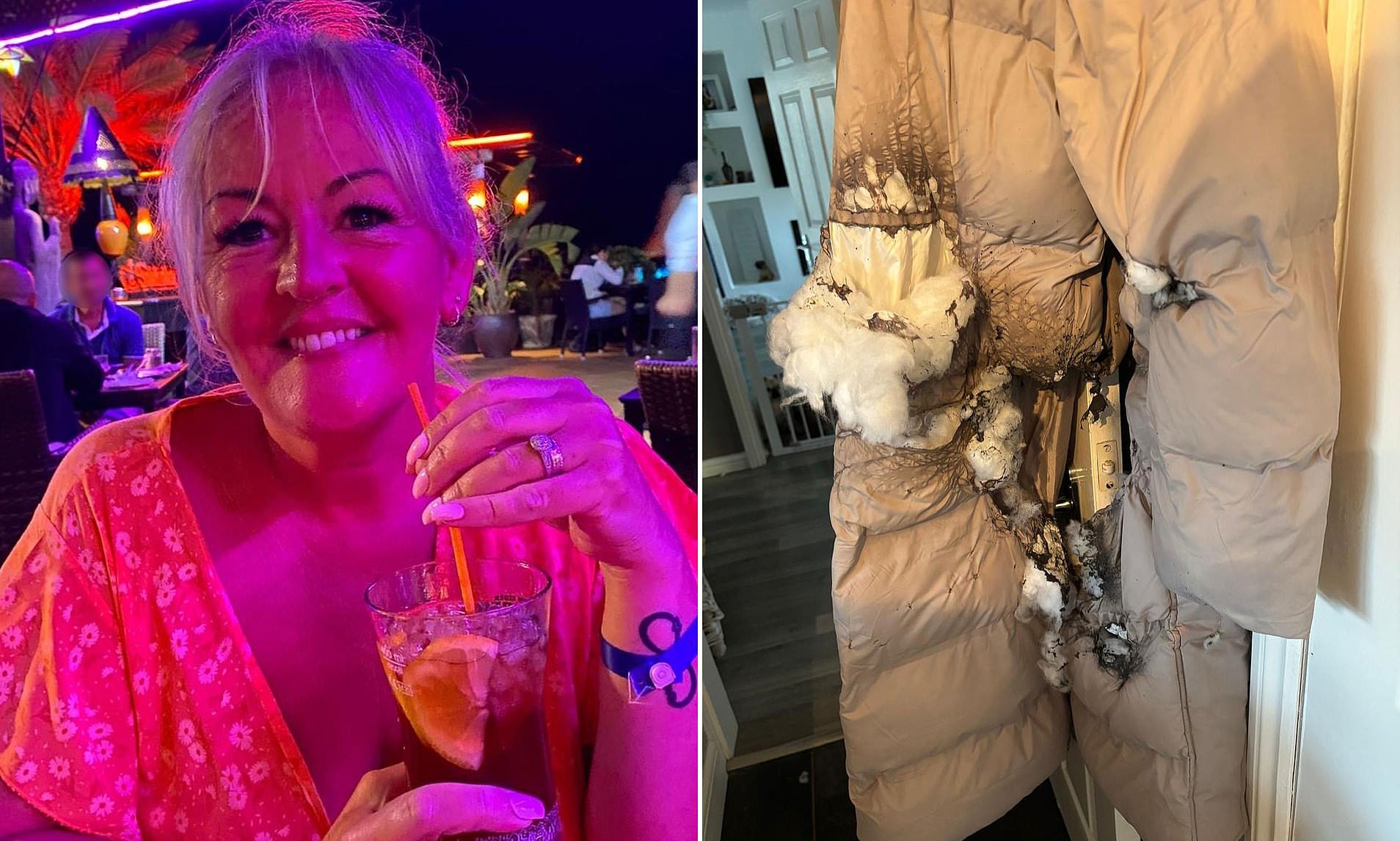 Woman, 52, left with horrific burns after vape exploded in her pocket ...