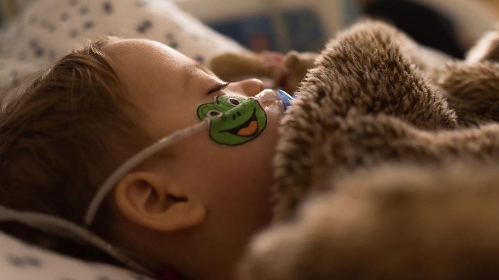 Surge in children with respiratory virus