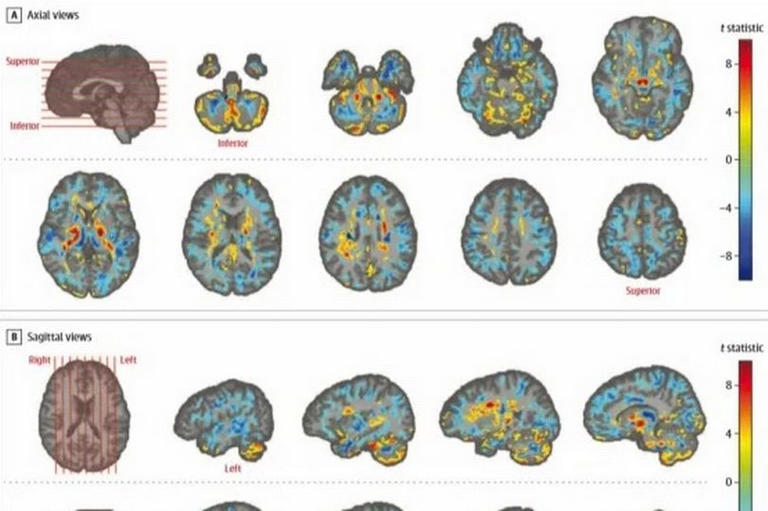 US testing Russian-made 'Havana syndrome' weapon acquired in undercover op