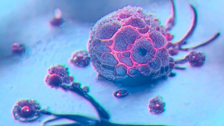 Scientists discover early gene change in pancreatic cancer