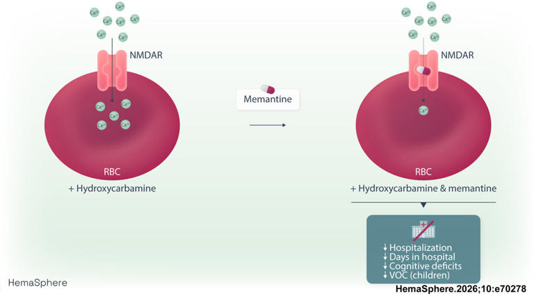 Safe, low-cost Alzheimer's drug demonstrates efficacy against sickle ...