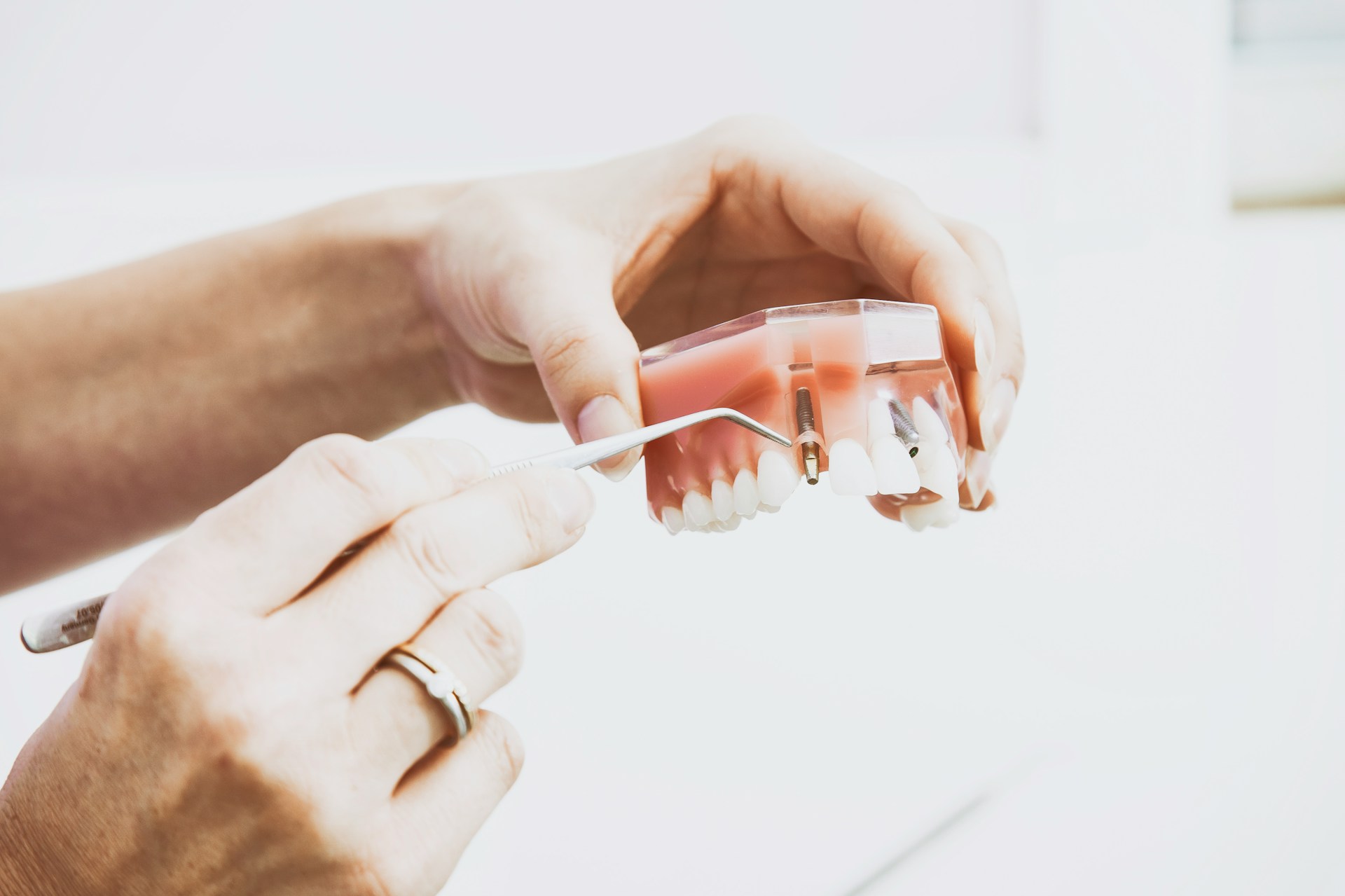 Canada Dental Care Plan income thresholds for 2026