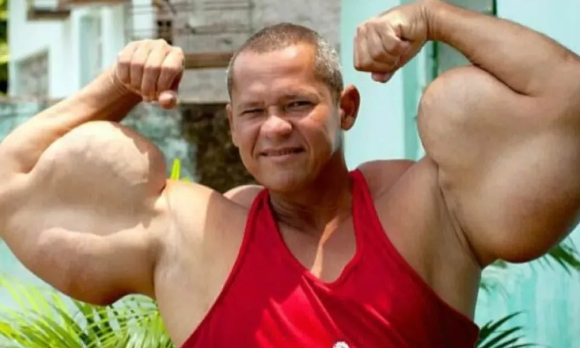 'Brazilian Popeye' bodybuilder famed for injecting alcohol and oil into ...
