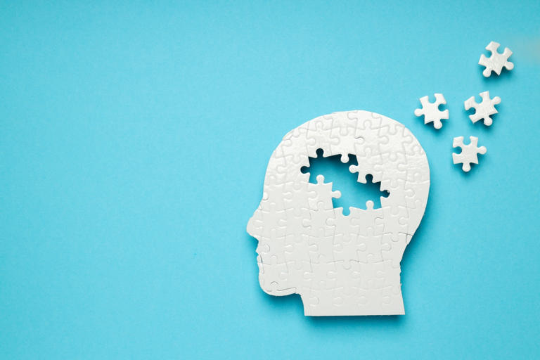 A week of 40-Hz sound triggers long-lasting amyloid changes in monkeys