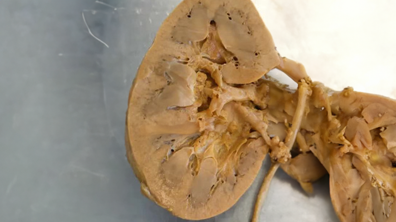 Understanding the body’s stress response