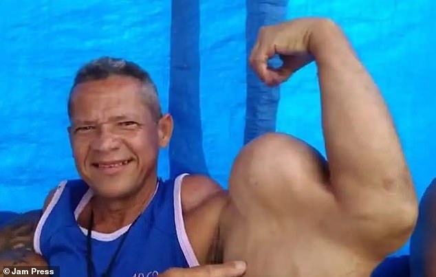 'Brazilian Popeye' bodybuilder famed for injecting alcohol and oil into ...