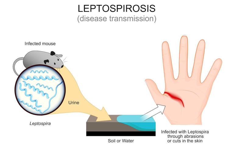 Homeless encampment at center of health alert over rat-borne disease