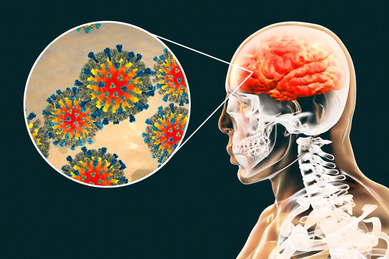 The hidden measles complication that can kill you years later — as ...