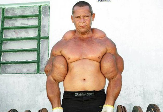 Brazilian 'real-life Popeye' dies at 55