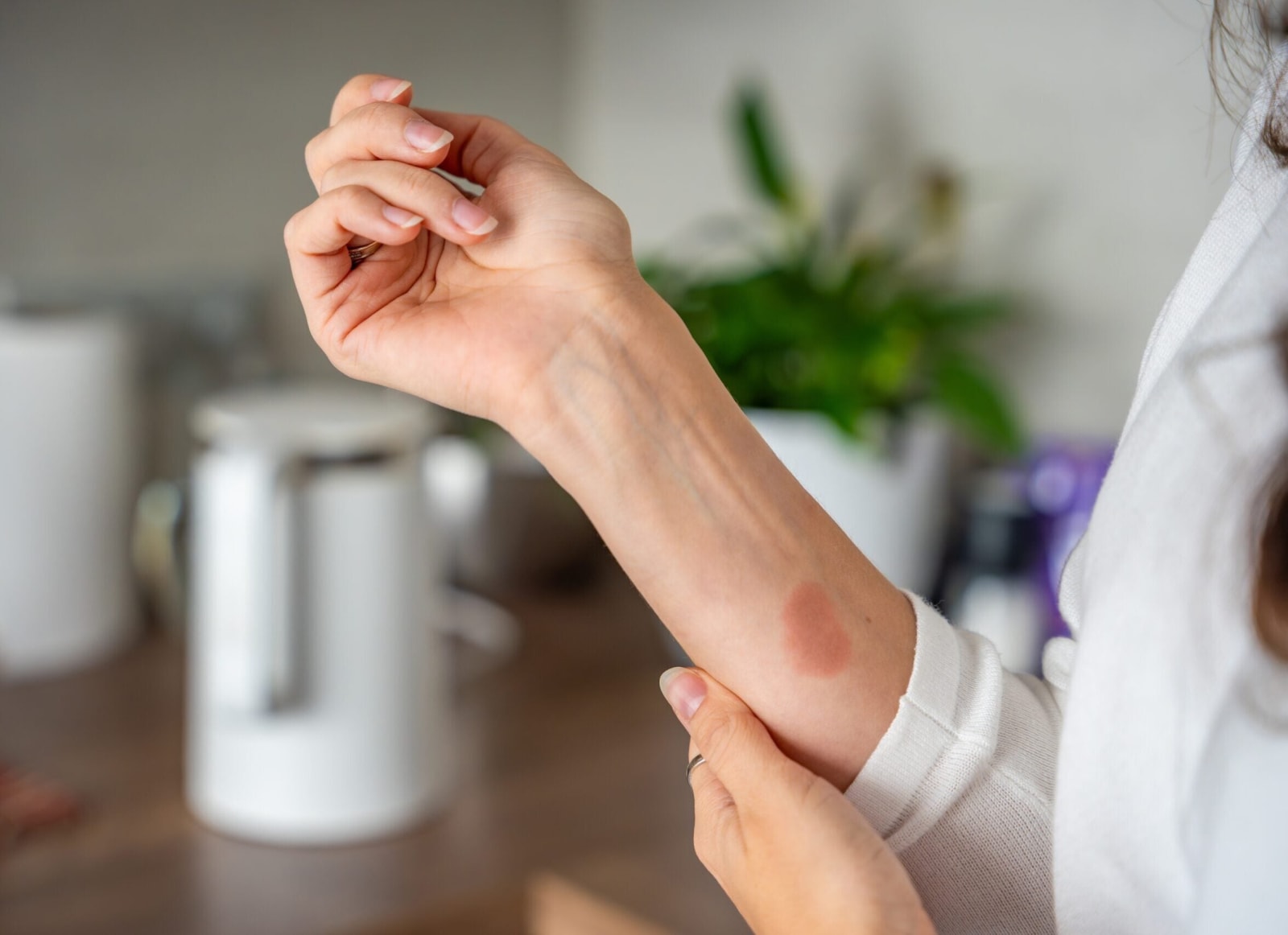 Scientists create skin graft health monitor that glows in response to ...