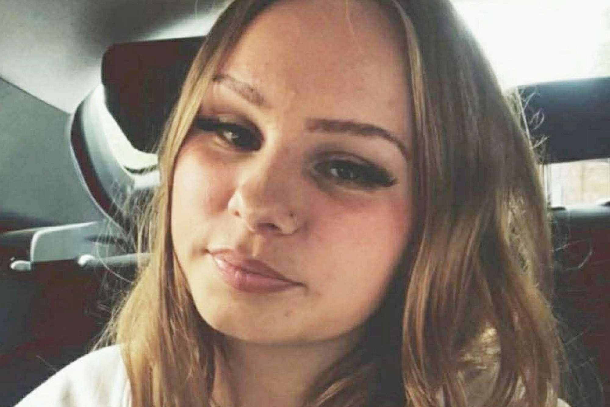 Teen left paralyzed, unable to speak after symptoms dismissed as ...