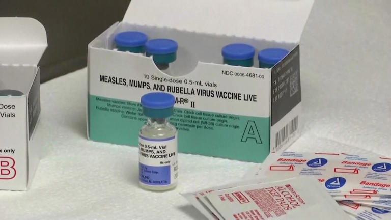 1st confirmed measles case of 2026 reported in Kentucky